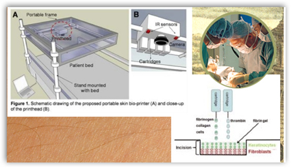 Researchers At Wake Forest Invent Ink Jets That Can Print Skin ...